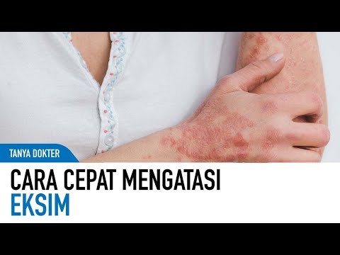 Cara Cepat dan Tepat Mengatasi Eksim di Rumah | Kata Dokter
