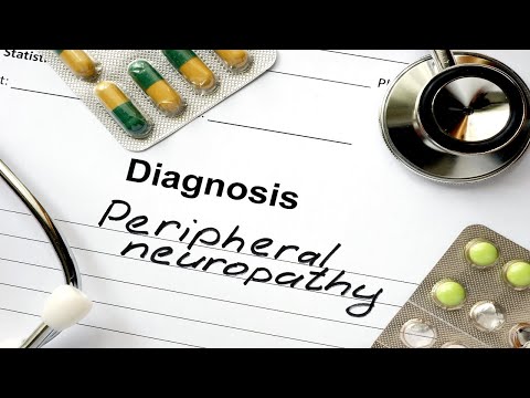 Idiopathic Neuropathy Treatment: My Severe Nerve Pain Is Finally Gone!
