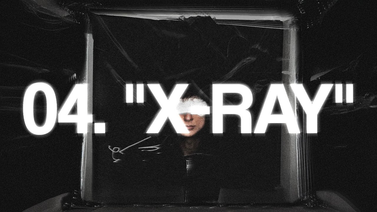 X-Ray by Mario from Estonia | Popnable