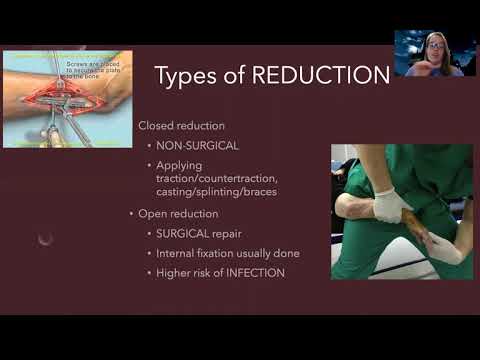 Med Surg: Breaking down Fracture Terminology