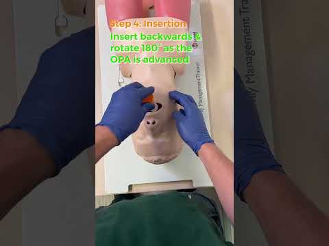 Master Oropharyngeal Airway Insertion Techniques #oropharyngealairway