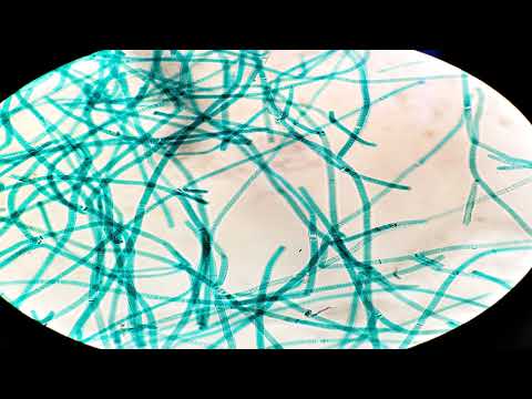 Learn about cyanobacteria | what is algae