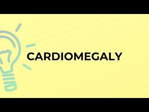 What is the meaning of the word CARDIOMEGALY?