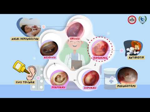 Otitis Media - dr. Ananda Listiarini