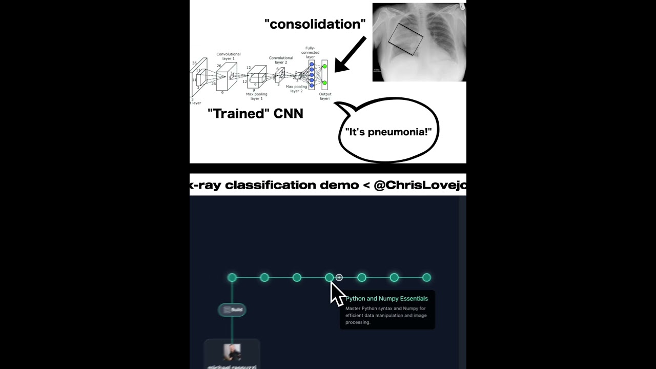 classification for chest x-ray 🌲 4/30 skilltrees.ai