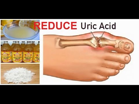 How to Lower Uric Acid Naturally – Natural Ways to Reduce Uric Acid ...