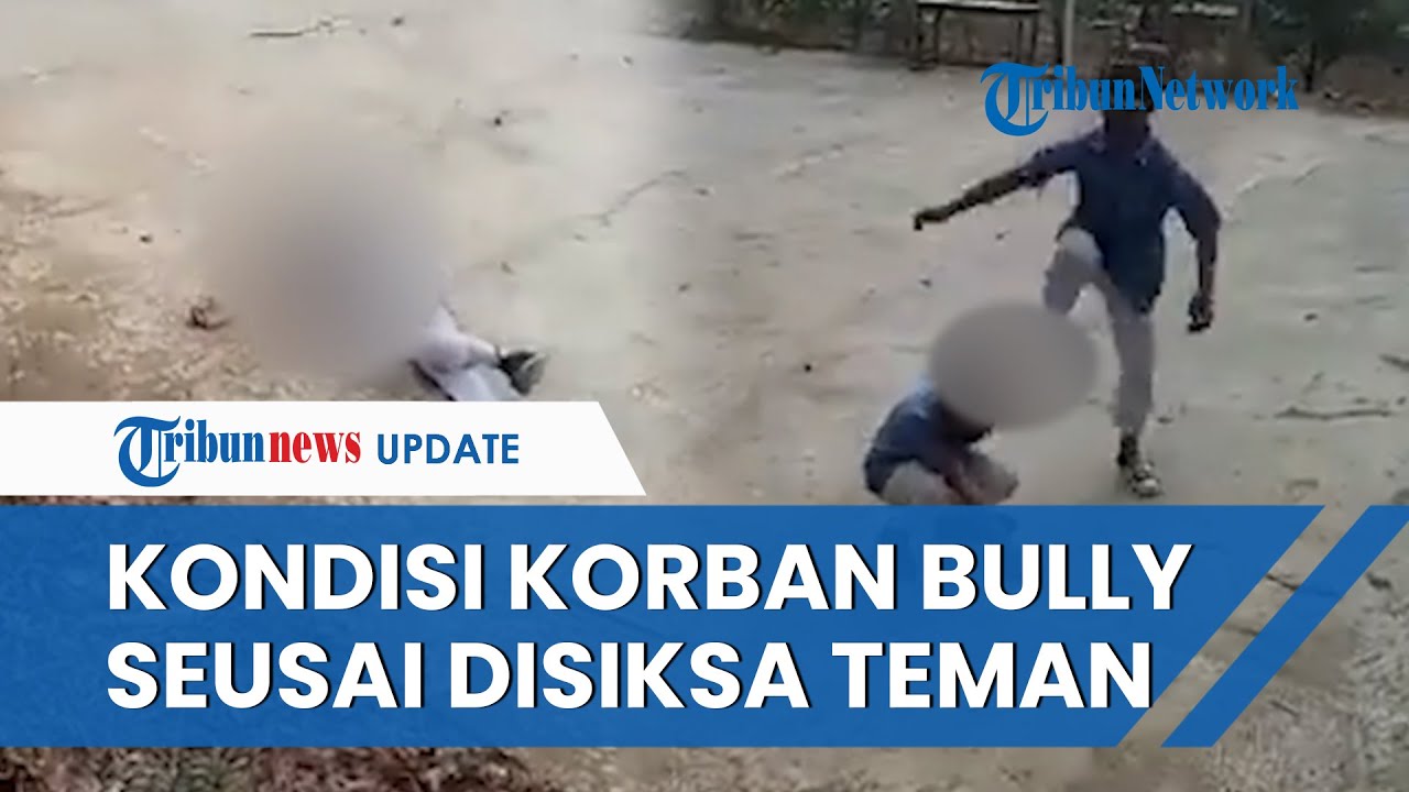 Memilukan! Begini Kondisi Siswa SMP Cilacap seusai Di-bully, Kakak ...
