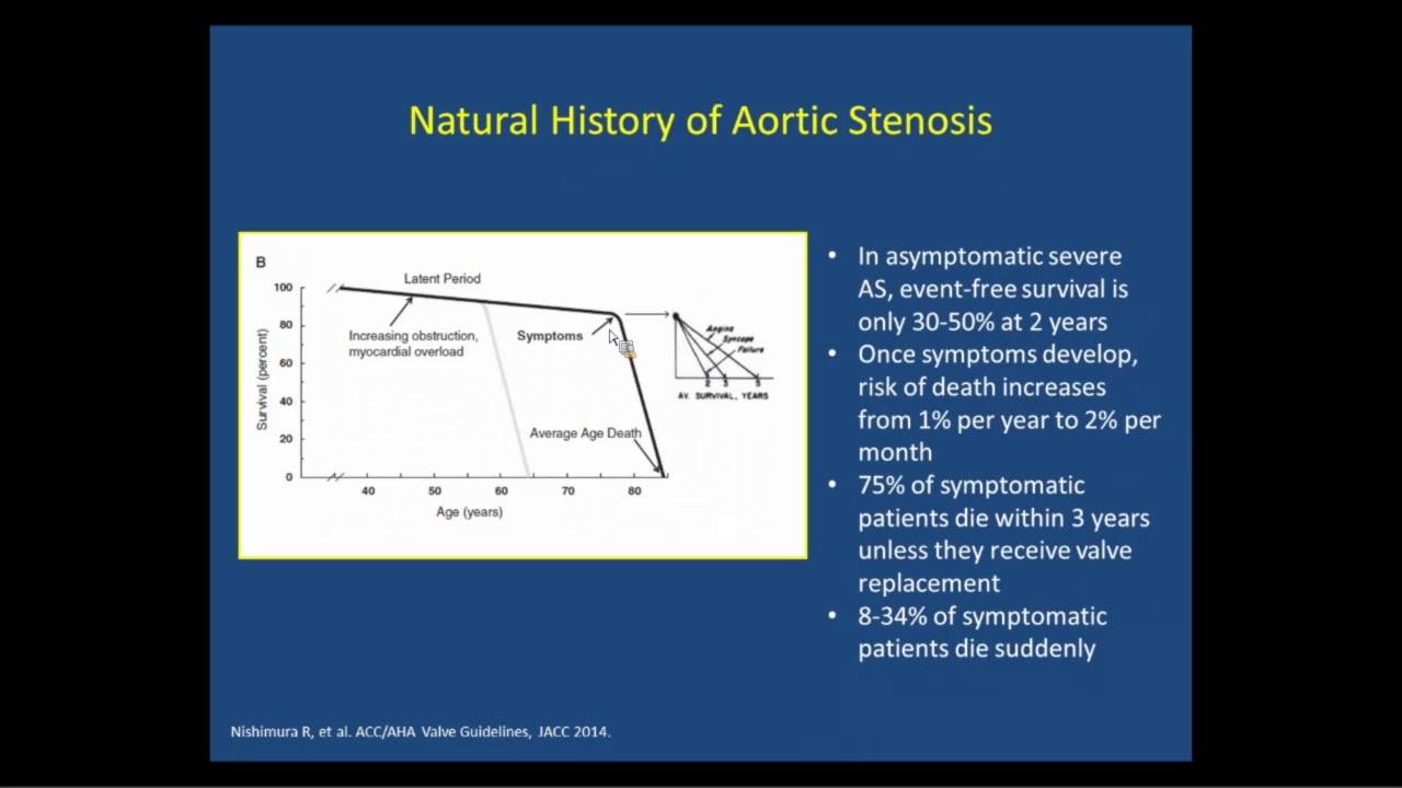 Aortic Stenosis: A Brief Overview