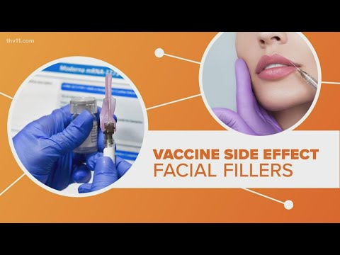 Unusual Moderna vaccine side effect | Connect the Dots