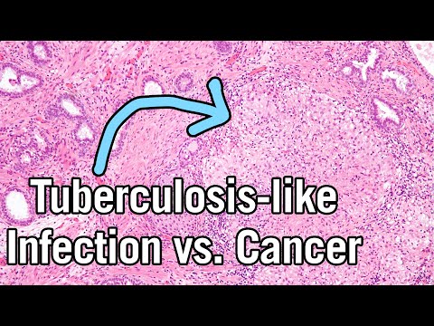 BCG Vaccine - Bacille Calmette Guerin Vaccine Latest Price ...