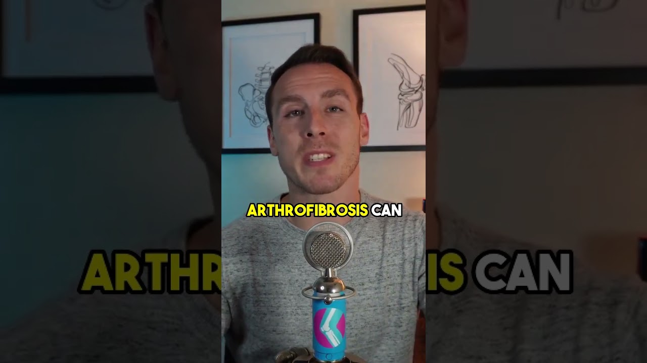 Arthrofibrosis: A Closer Look at this Common Complication of ACL Surgery