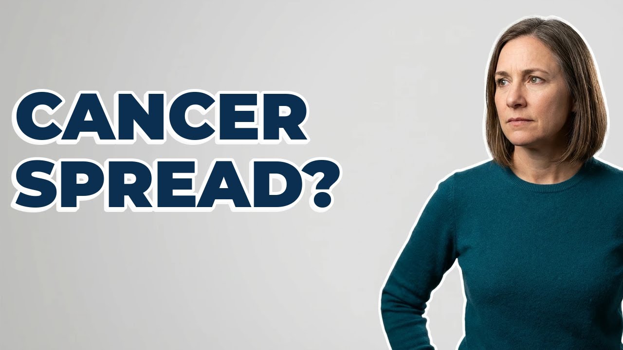 Can A CT Scan Detect Stomach Cancer Spread?