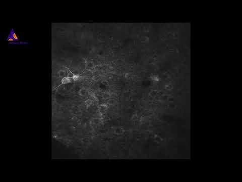 In vivo imaging of GCaMP6f-expressing neurons in the visual cortex (V1) of awake, behaving mice