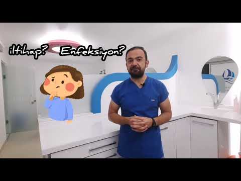 İltihaplı, apseli dişler çekilebilir mi? İltihap ve enfeksiyon nedir? Antibiyotik almak şart mı?