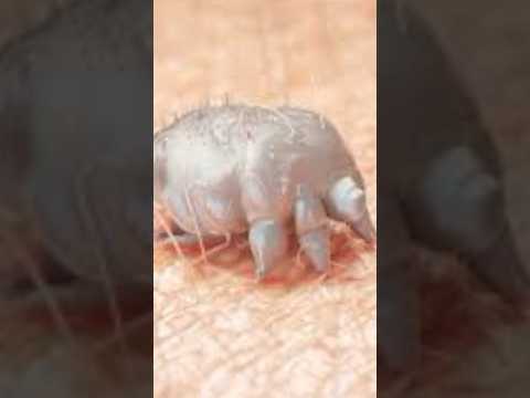 They Can REPOPULATE under YOUR Skin: Scabies Mites #animals #parasites #gross