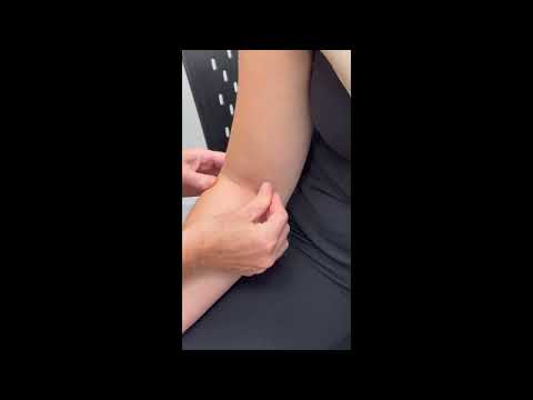 McMaster Medical Acupuncture Program: Pericardium 3