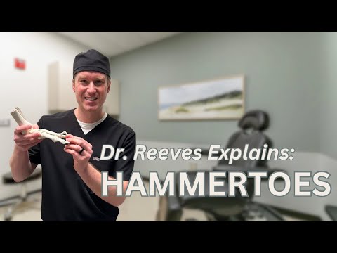 Hammertoes: Causes, Symptoms, Treatments