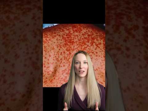 ‼️Measles Outbreak ‼️ #measlesoutbreak #2025 #health