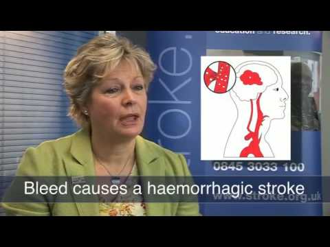 What is a stroke?