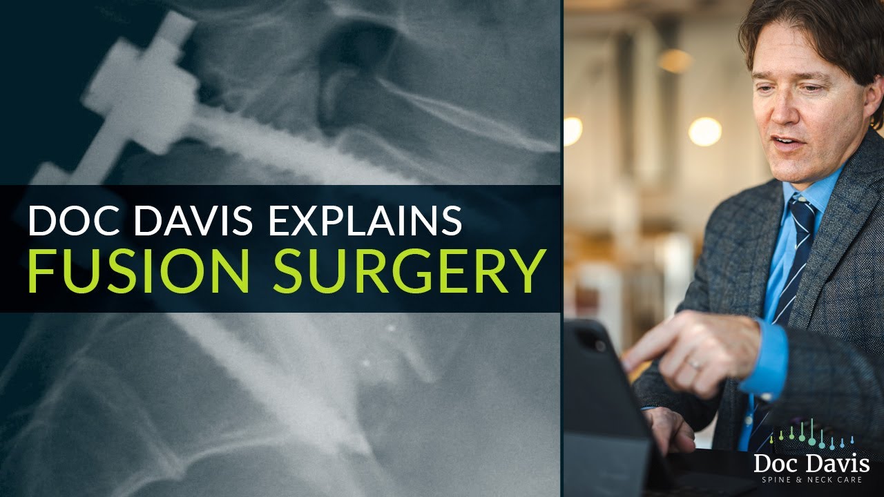 Doc Davis Explains Fusion Surgery
