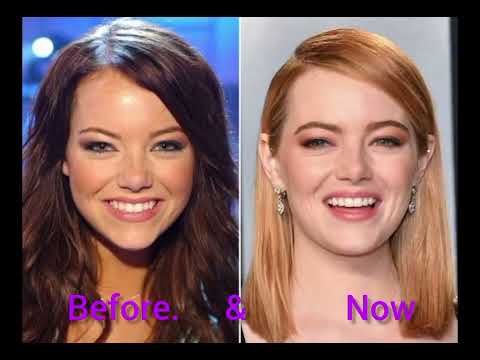 The Most famous Female Hollywood Actors — Then vs Now