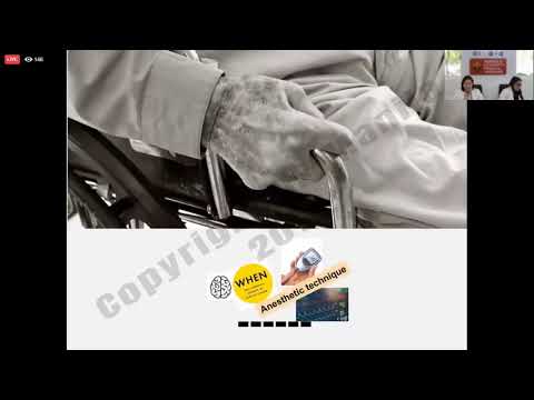 Peri-operative Stroke: Risks, Diagnosis and Updates