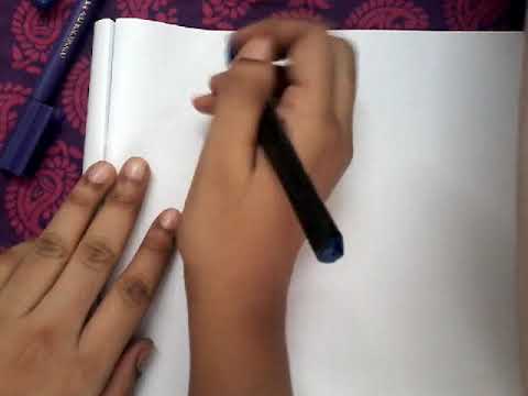 Horseshoe kidney || kidney || renal