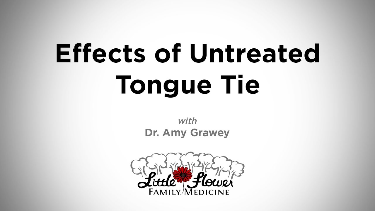 Effects of Untreated Tongue Tie