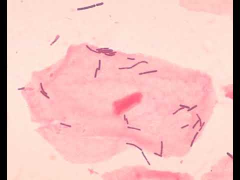 Biopreservation | Wikipedia audio article