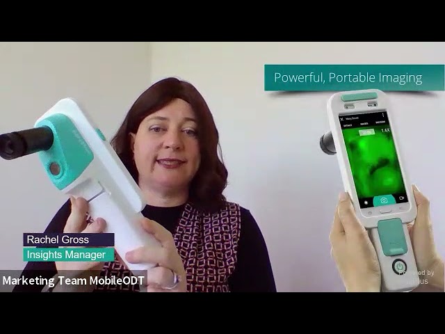 Cervical Cancer - Eva Colposcope Mobile Odt Trader - Wholesaler ...