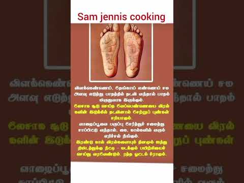 பாத எரிச்சல் குணமாகும் #shorts