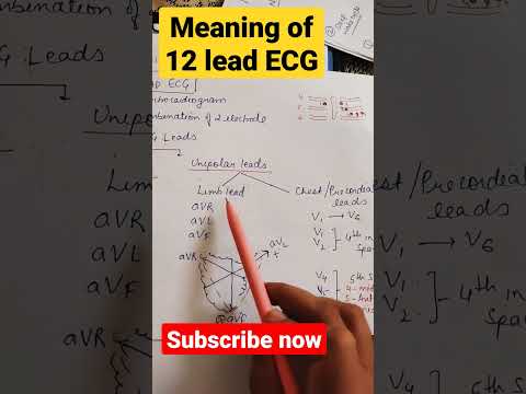 12-lead ECG meaning