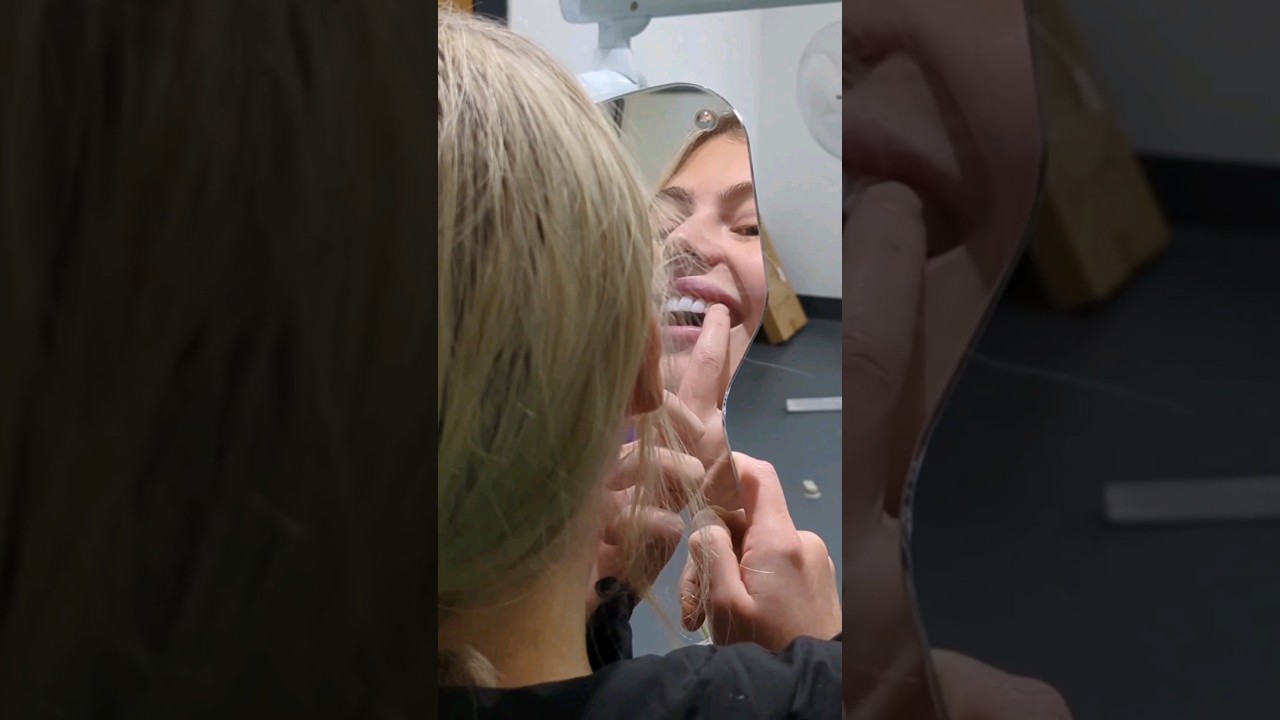 Composite Bonding | Smile Transformation! | Synergy Dental Clinic - Bury |