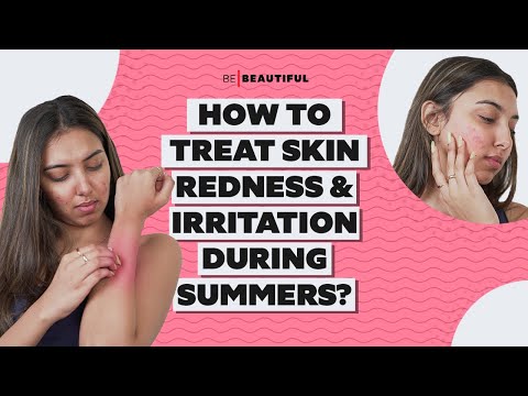 How To Treat Skin Redness/Irritation During Summer Season | skincare tips | Be Beautiful