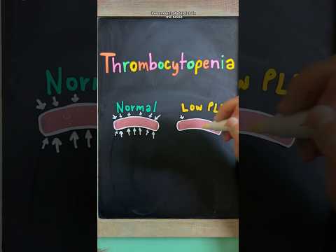THROMBOCYTOPENIA Review for Nursing Students #nursingstudent