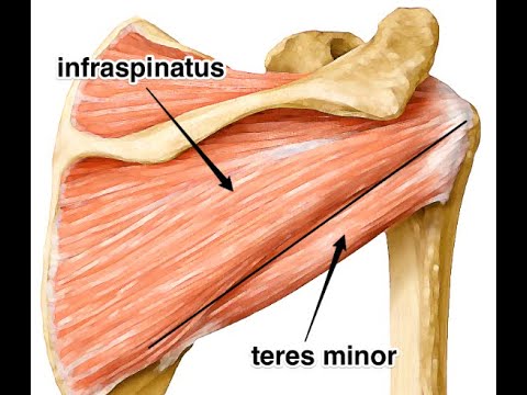 The infraspinatus and its role in subacromial impingement: Mechanism and treatment