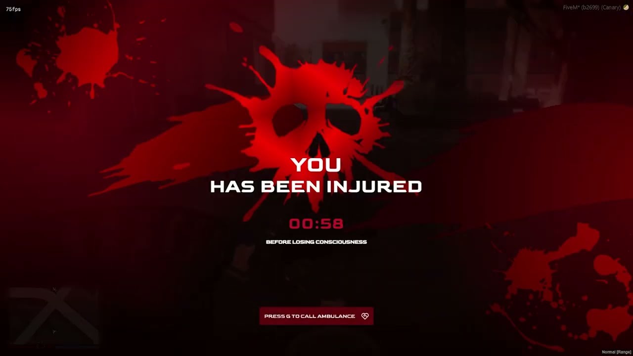 [FREE] [ESX/QB] Buzzer-DeathScreen