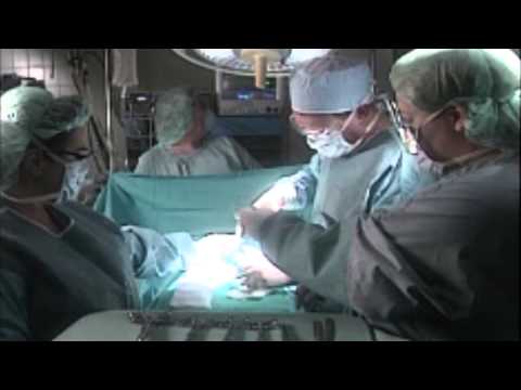 Next Generation Medical Brush Technology - Sanderson MacLeod