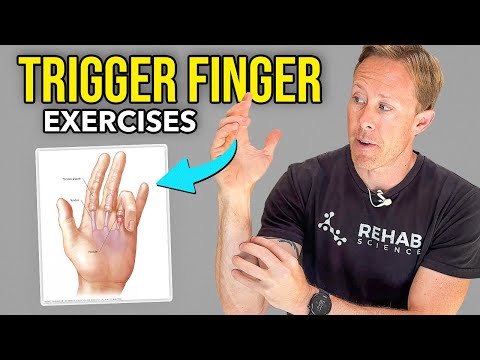 5 Trigger Finger Rehab Exercises