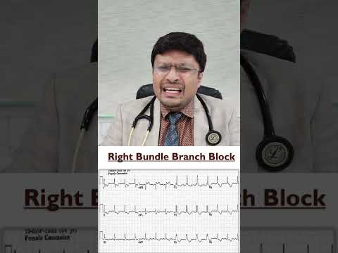 जानिए #RBBB क्या होता हैं ?और ये क्या हैं?WHAT IS RBBB? How does it affect life?