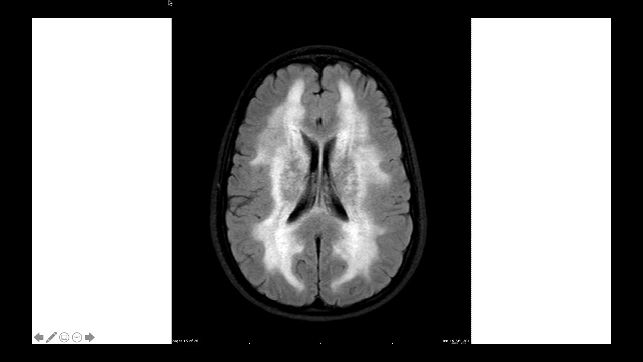 How to add scrollable stack of CT or MRI Images on Microsoft PowerPoint 365 (2020) - Radiology