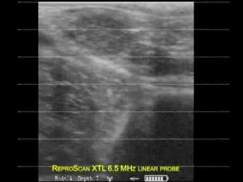 Open (Empty) Uterus and CL with ReproScan XTL 6.5 MHz linear rectal probe