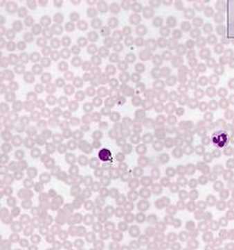 Shotgun Histology Blood Smear