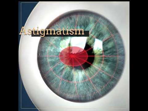 What is Astigmatism?