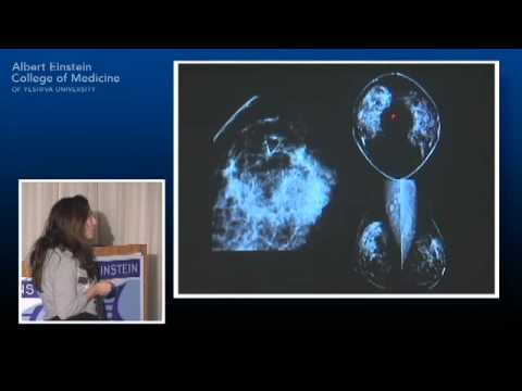Community Health Lecture Series: Breast Cancer, 1 of 4