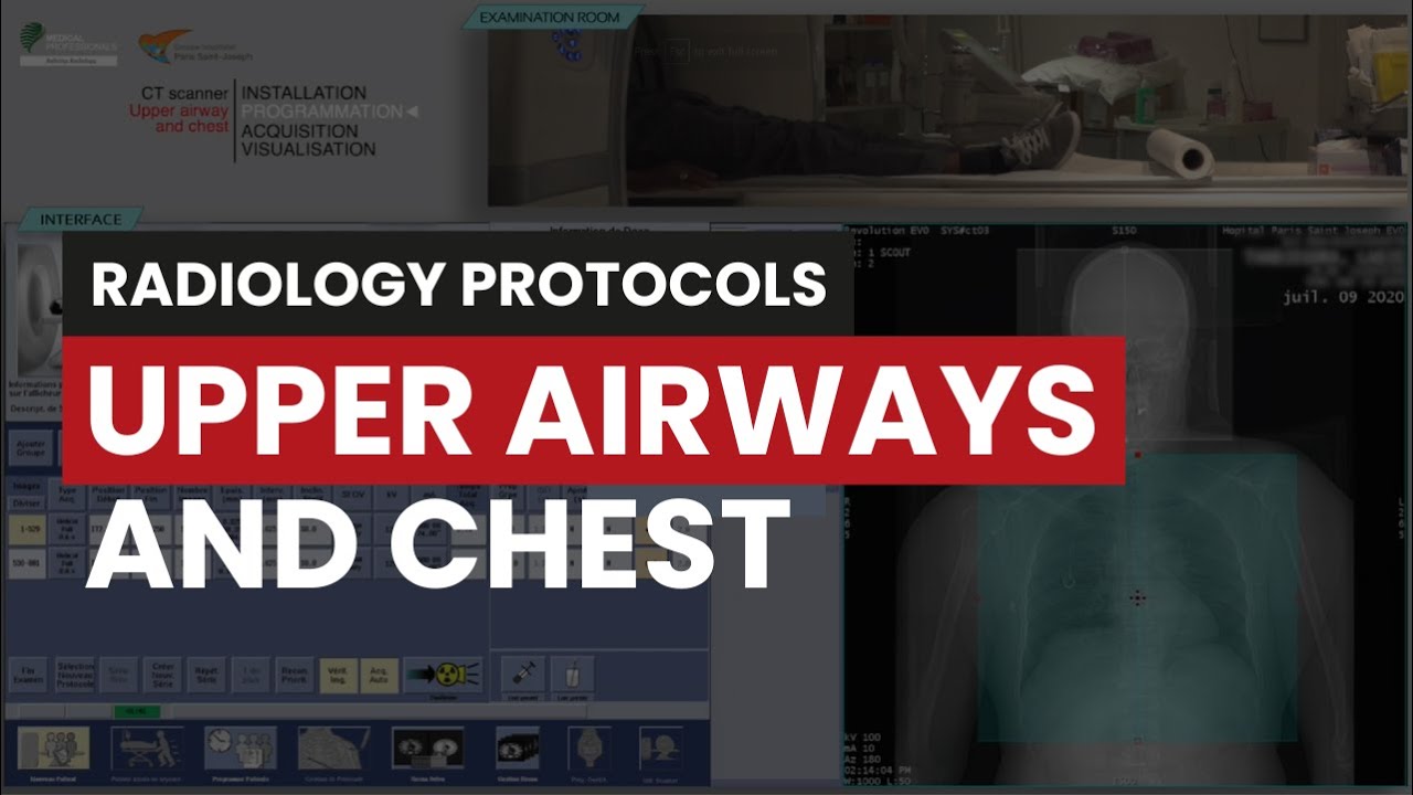 Cervicothoracic (Upper Airways) Computed Tomography Protocol Tutorial