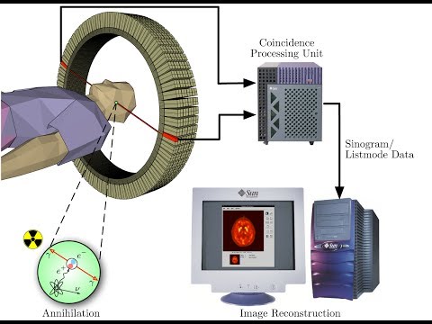 how does PET Scan Works