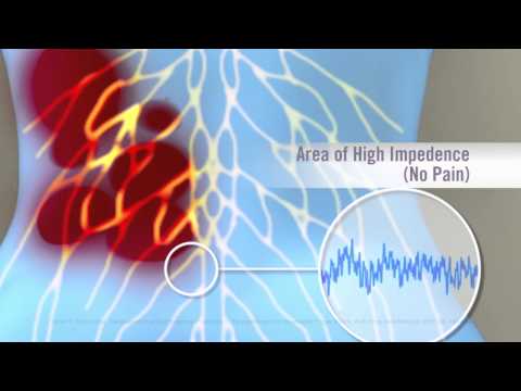 Nervomatrix - Israeli Startup | Startup Nation Finder