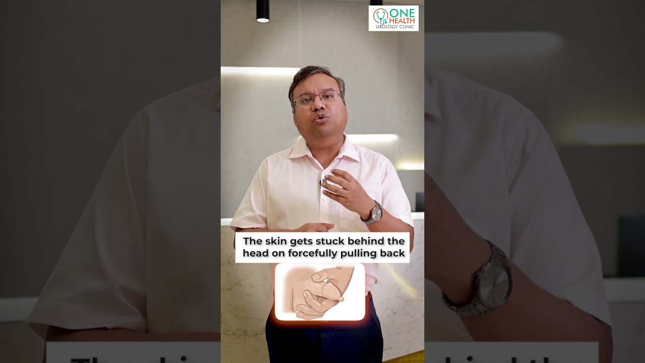 Phimosis vs Paraphimosis: Causes, Symptoms and Treatment | Dr Shalabh Agrawal #shorts