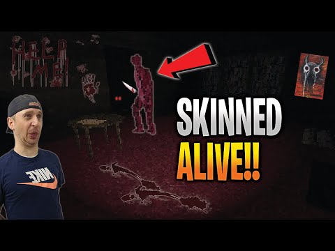 Steam Community :: Video :: THIS DERANGED LUNATIC WAS SKINNING PEOPLE ALIVE!! *Crazy* Thy Flesh ...
